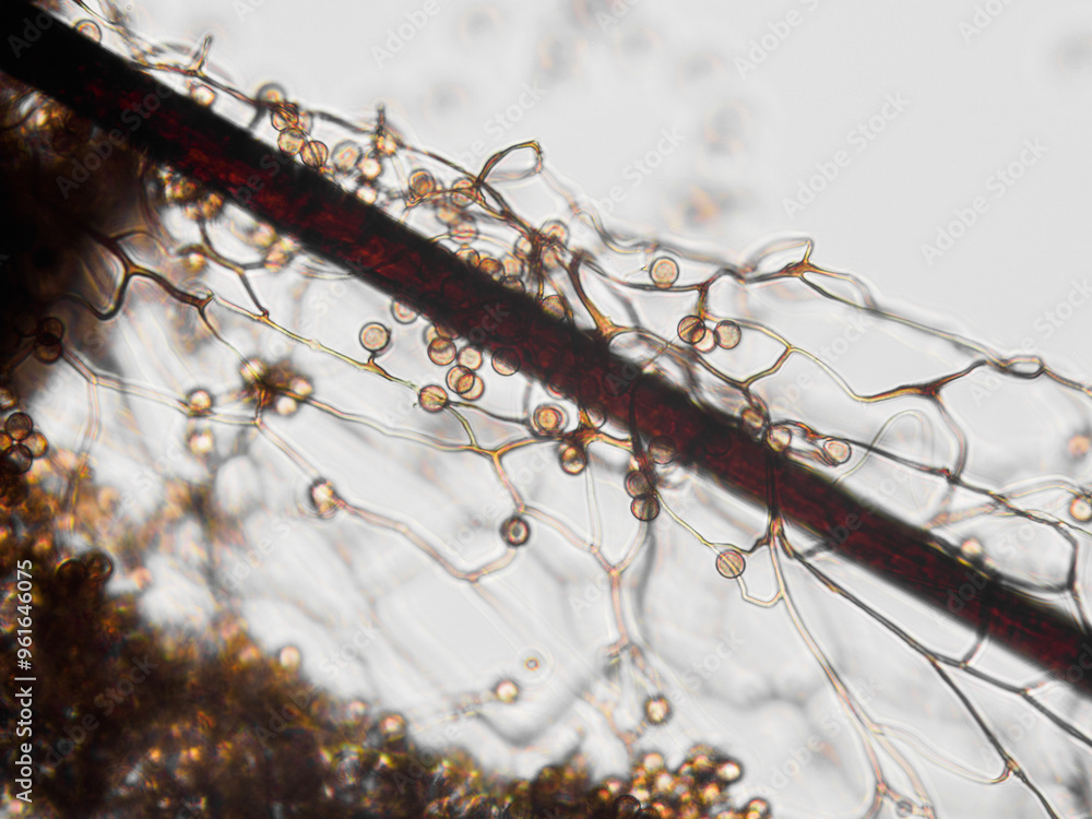 Spores, sporangia, mycelium, hypha of Stemonitis Splendens slime mold ...