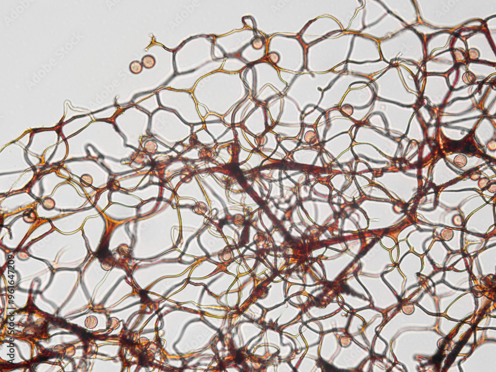 Spores, sporangia, mycelium, hypha of Stemonitis Splendens slime mold ...