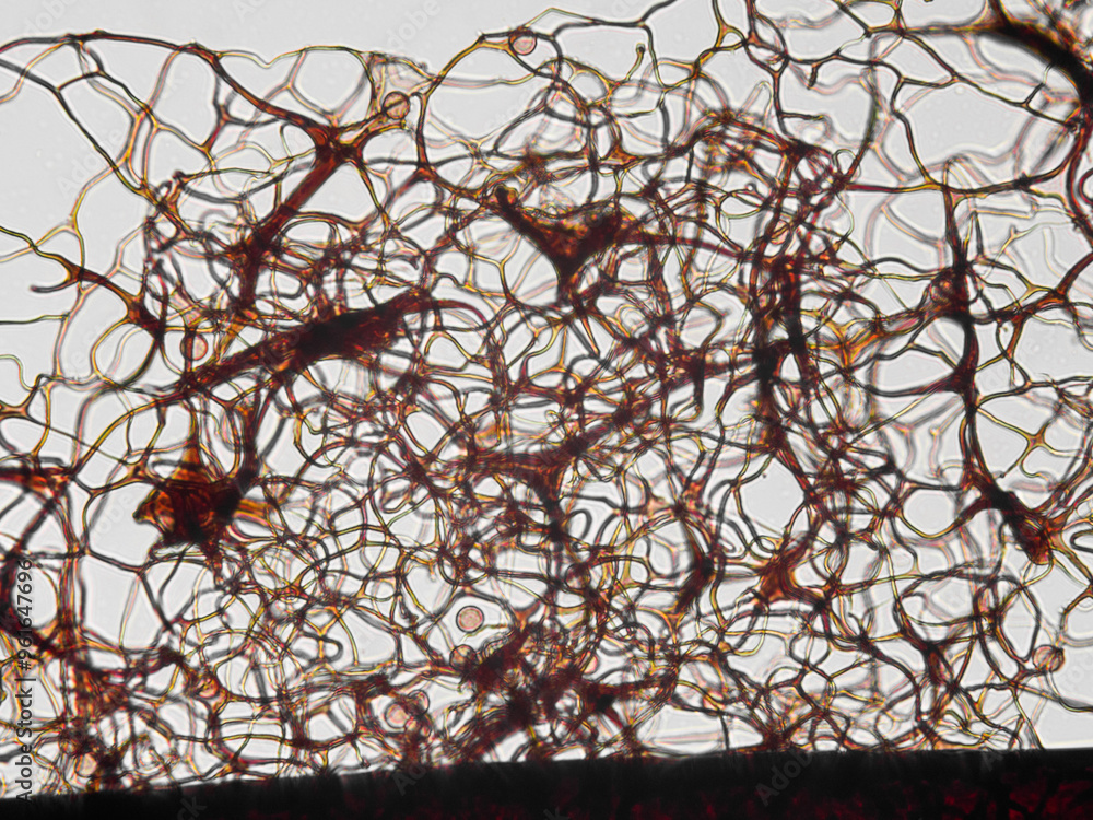 Spores, sporangia, mycelium, hypha of Stemonitis Splendens slime mold ...