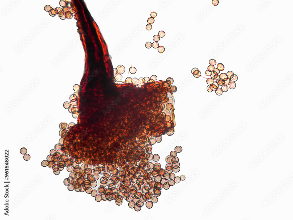 Spores, sporangia, mycelium, hypha of Stemonitis Splendens slime mold ...