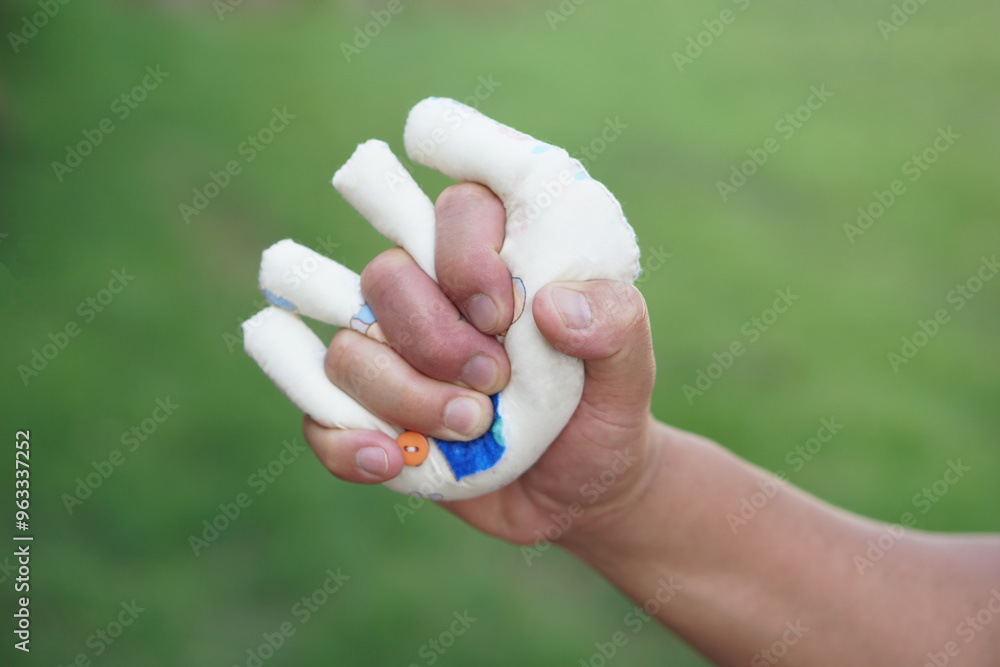 Hand muscle exercises for paralyzed patient by squeezing soft objects ...