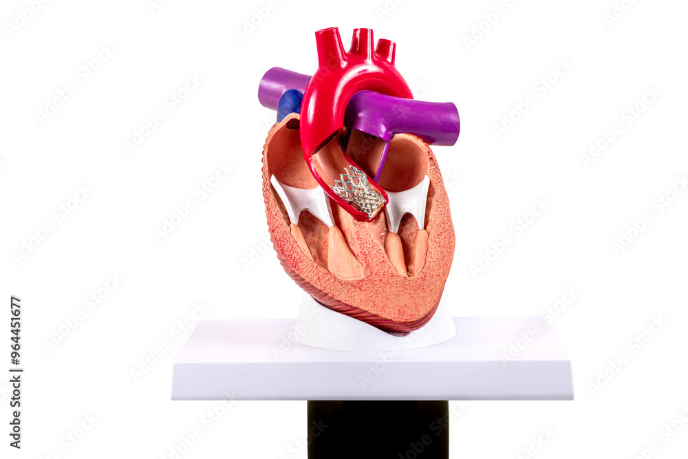 Cardiac model of Transcatheter aortic valve implantation (TAVI) for ...
