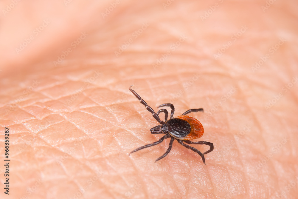 Parasite castor bean, black-legged or deer tick on human skin detail ...
