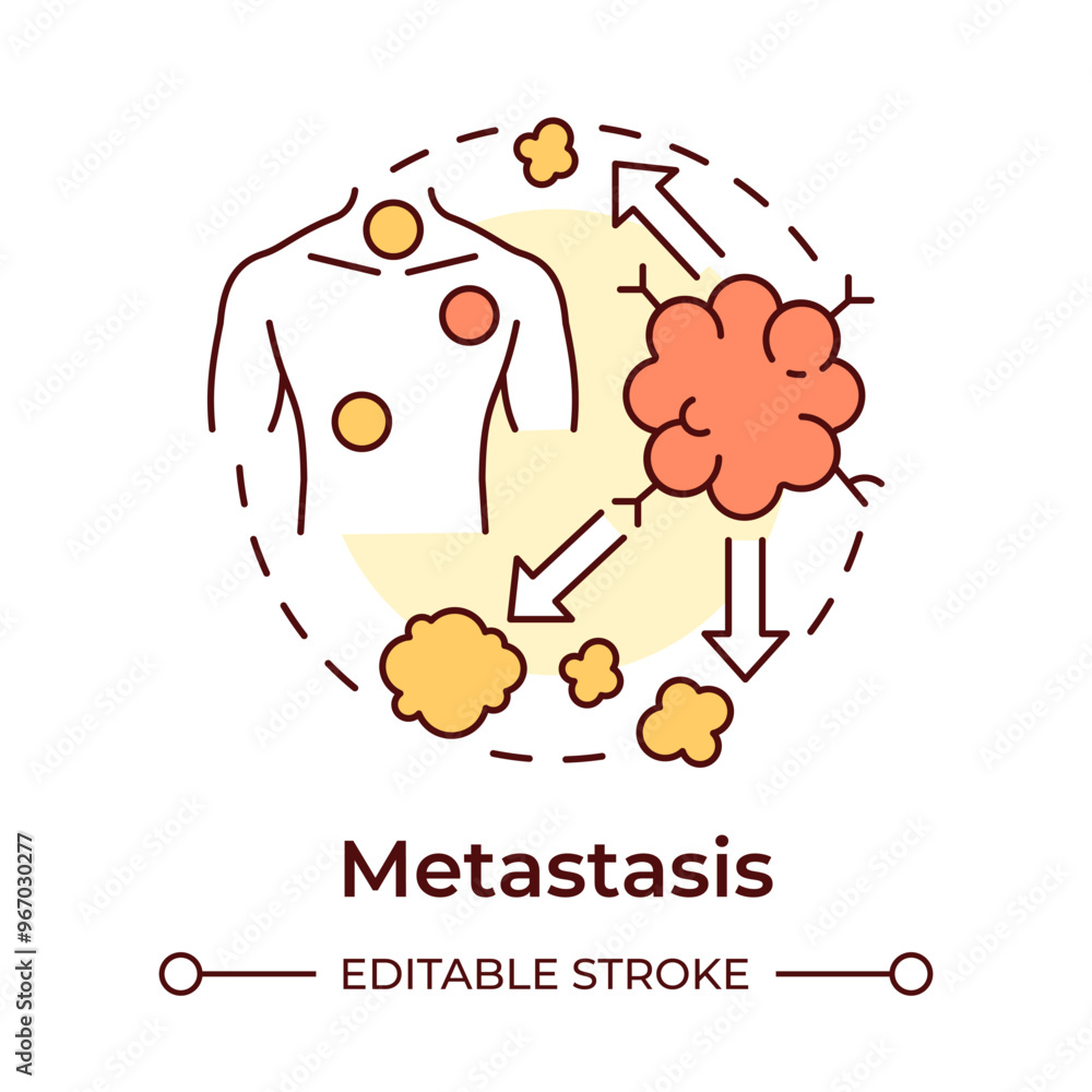 Metastasis multi color concept icon. TNM system. Cancer spread ...