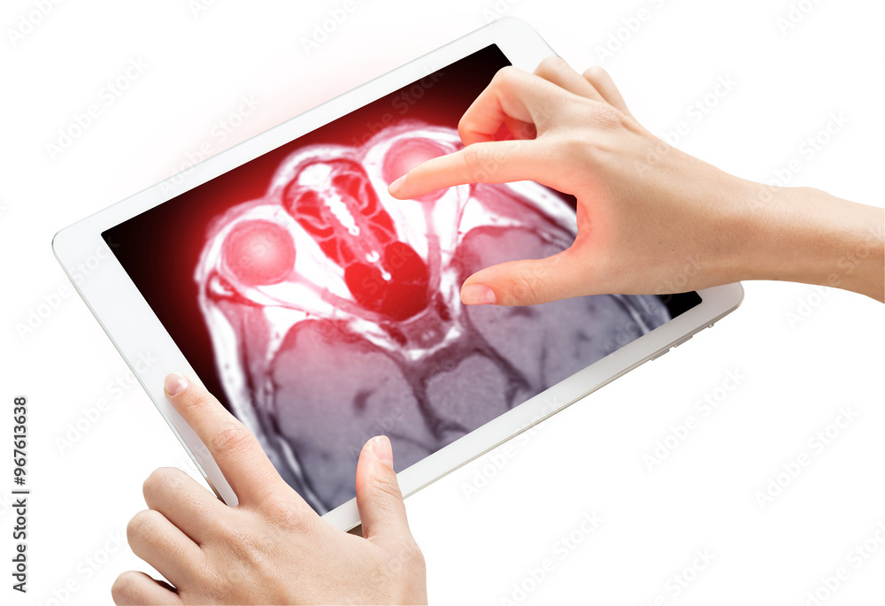 The hand gestures towards a tablet displaying detailed of MRI orbit ...