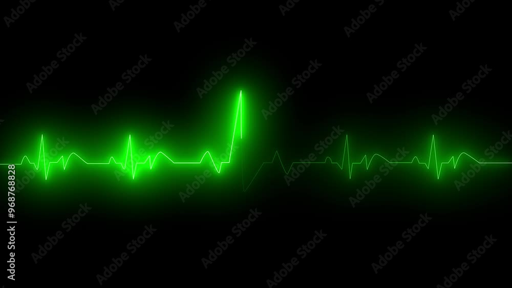 Neon Digital Heartbeat Plus Animation. Neon heartbeat on black isolated ...