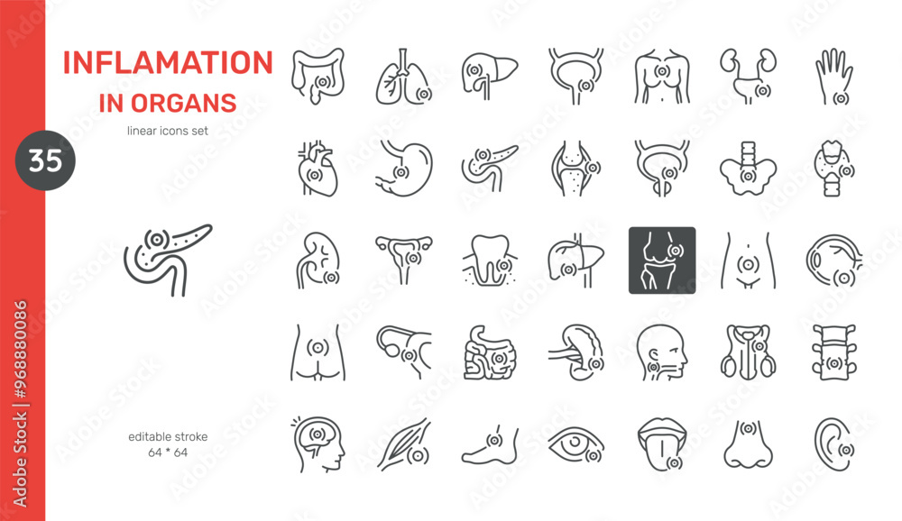 Inflammation in Human Organs Icons Set. Thin linear icons representing ...