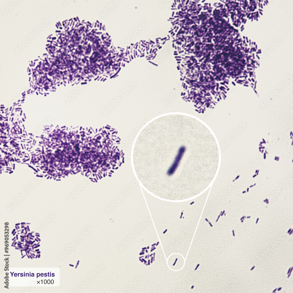 This is the bacillus pestis, the pathogen that caused the Black Death ...