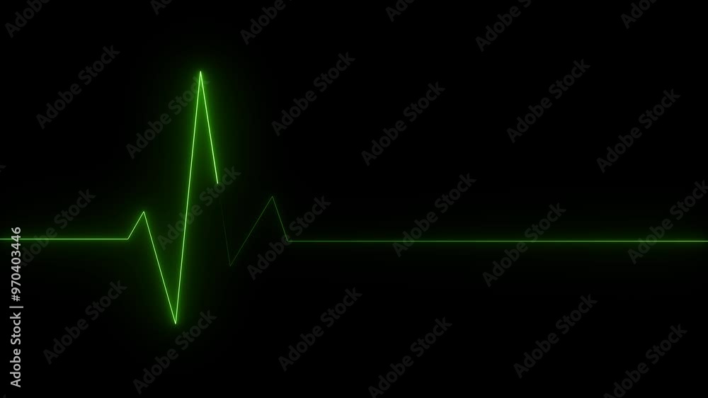 Green Bright heart rhythm background 4K heartbeat monitor EKG line ...