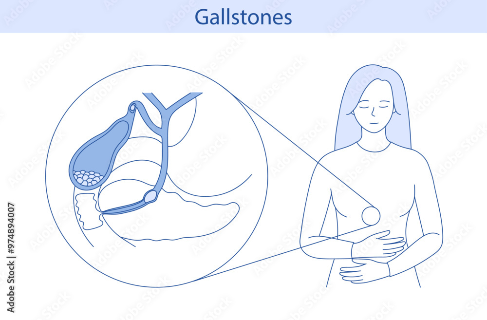 Schematic vector illustration of the structure of the gallbladder with ...