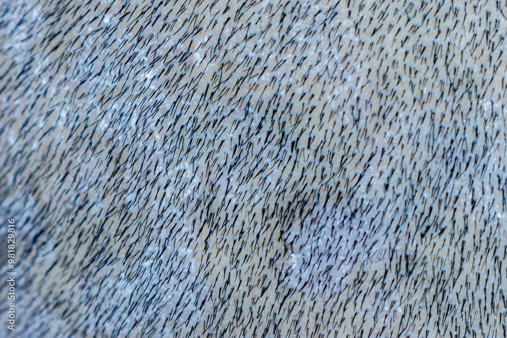 Foto de Scalp fungal infection that causes skin disease at the head ...