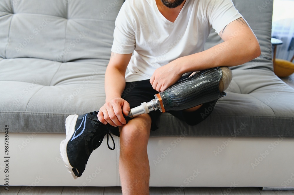 Man amputee with prosthetic leg disability on above knee transfemoral ...