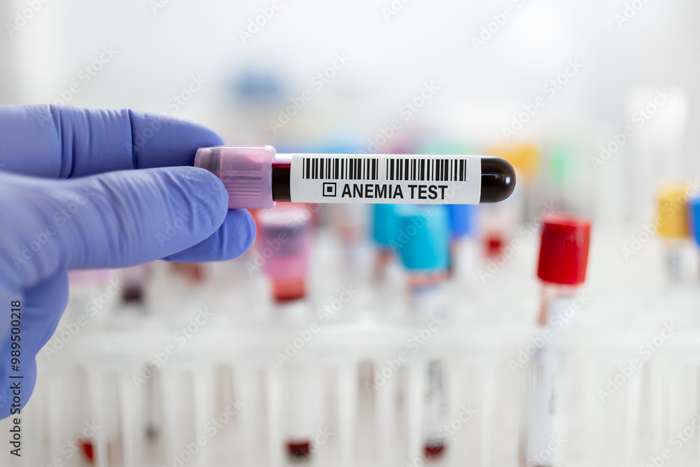 Doctor holding Sample of blood testing tube, to perform analysis of ...