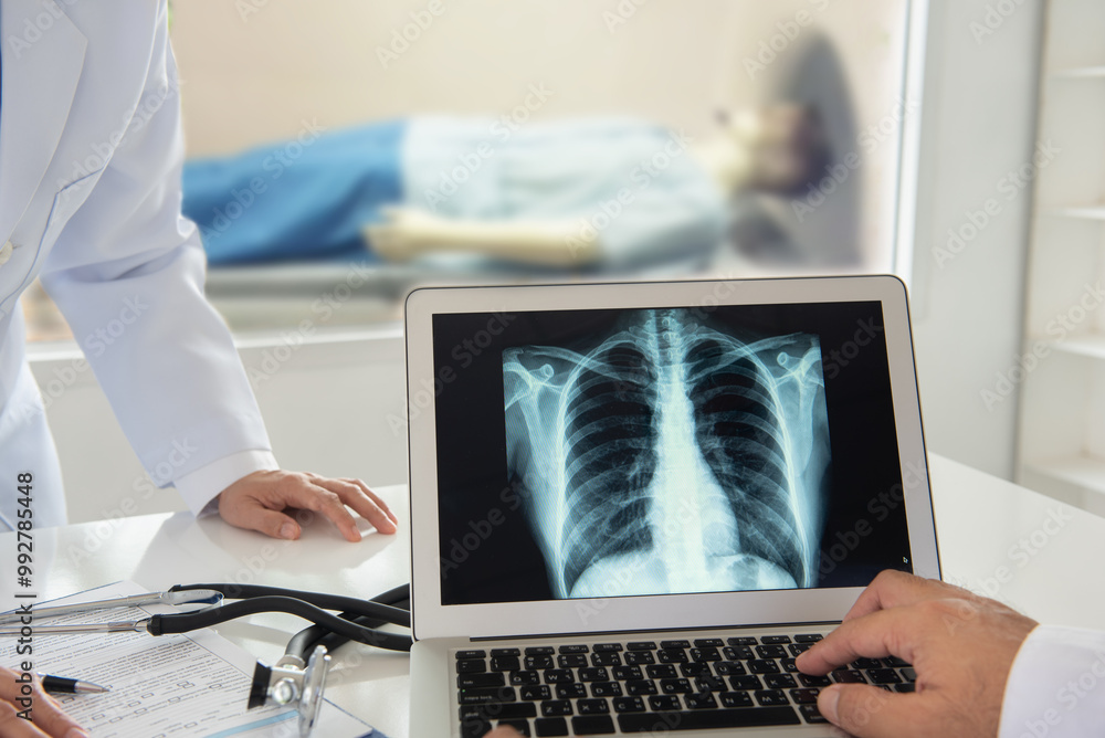 doctor team diagnose lung x-ray image by ct scan or mri to diagnose ...
