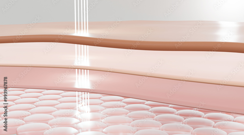 laser or serum vitamin through the skin layer for repair wrinkles and ...
