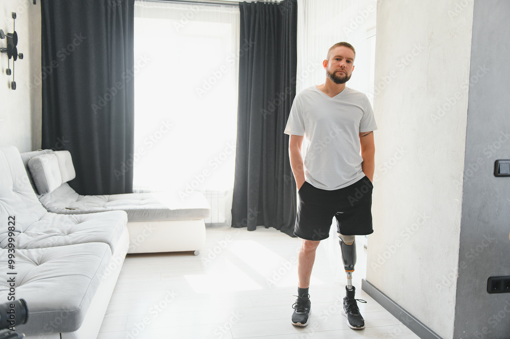 Man amputee with prosthetic leg disability on above knee transfemoral ...