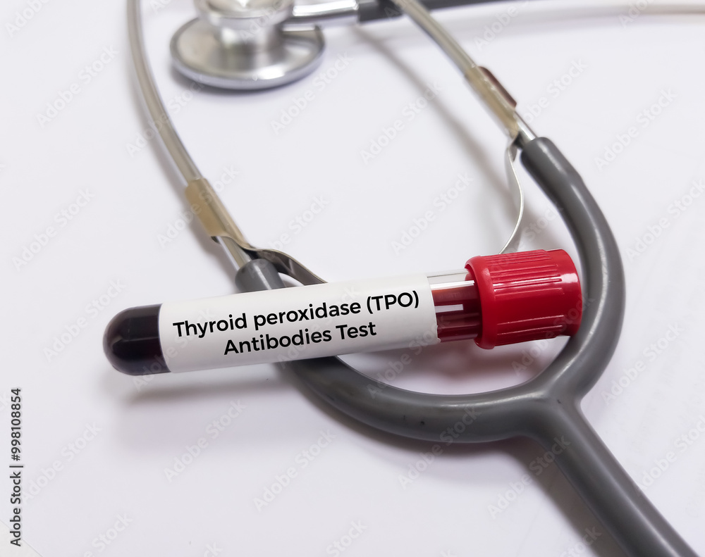 Blood sample for Thyroid Peroxidase Antibodies or Anti-TPO test and ...