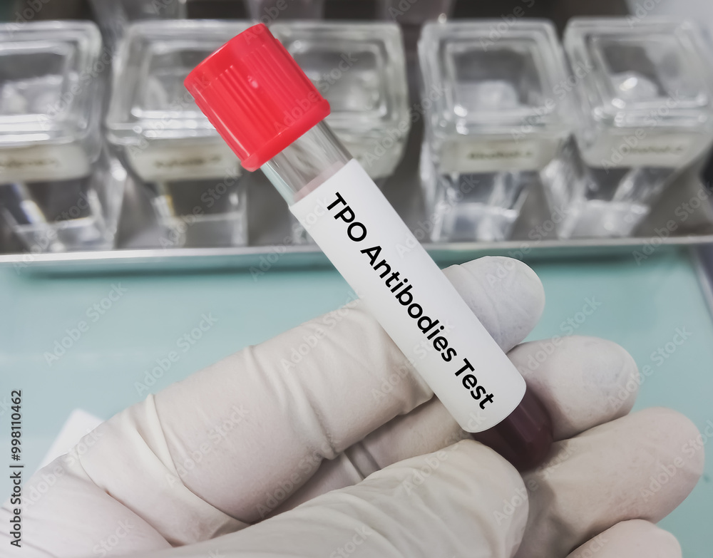 Blood sample for Thyroid Peroxidase Antibodies or Anti-TPO test and ...