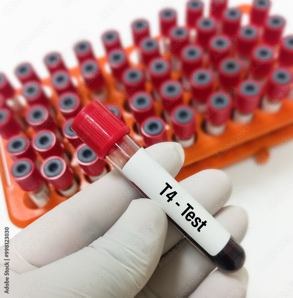Blood sample for Thyroid function tests or thyroid panel test (T3,T4 ...