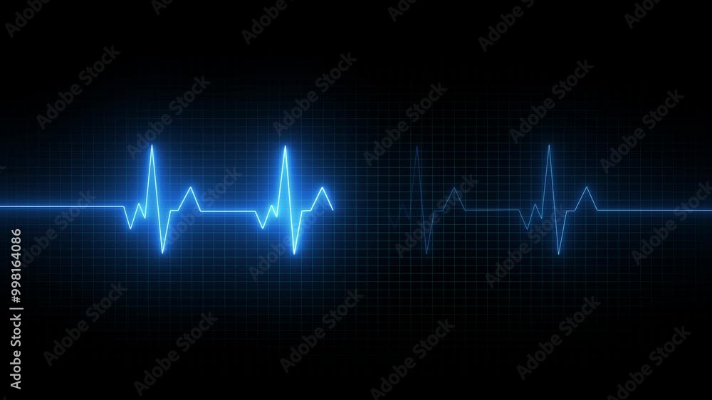 Dynamic heart rate or heart beat line. Patient monitor displays vital ...
