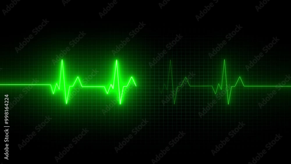Dynamic heart rate or heart beat line. Patient monitor displays vital ...