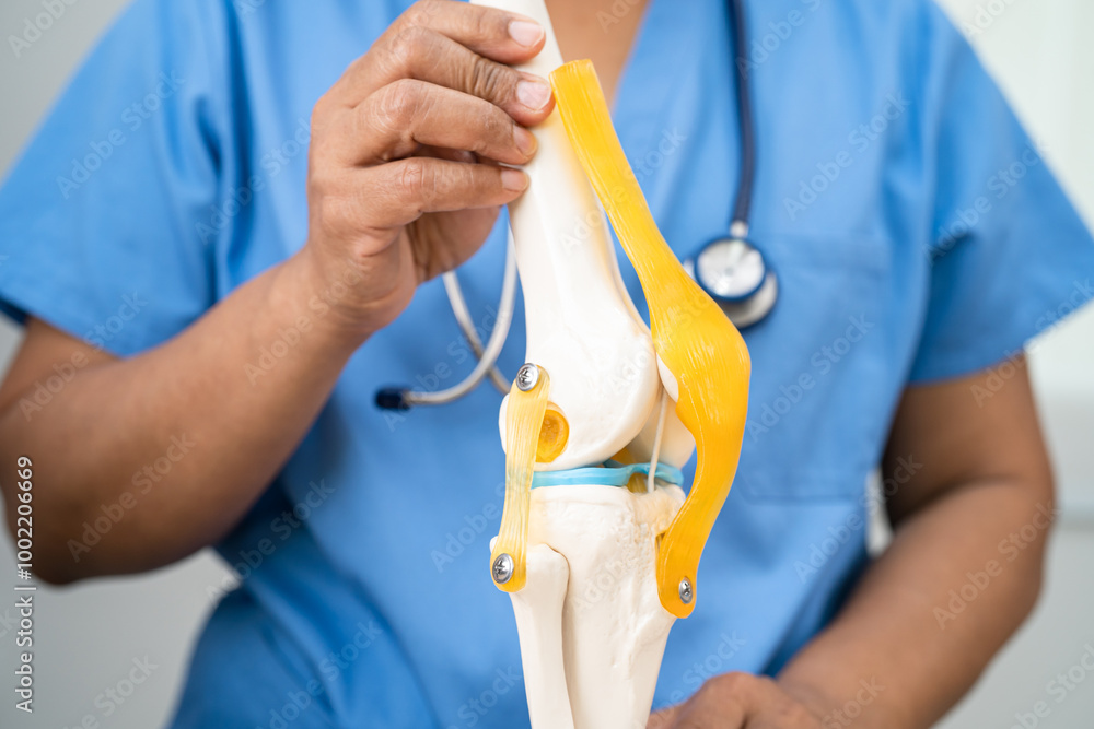 Osteoarthritis of the knee, Doctor holding human knee joint orthopedic ...