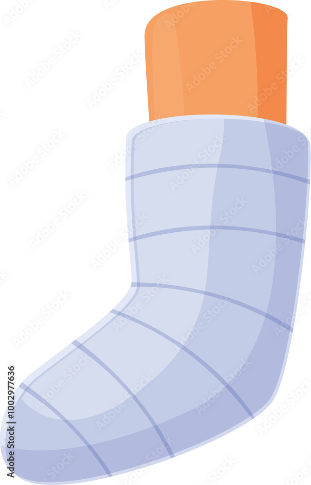 Blue plaster cast is covering injured leg after fracture, providing ...