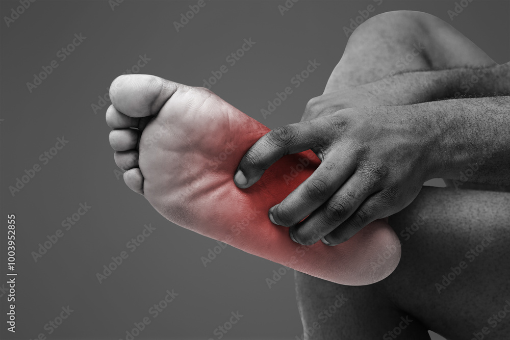 Afro man scratching bare foot, Athlete's foot syndrom, common skin ...