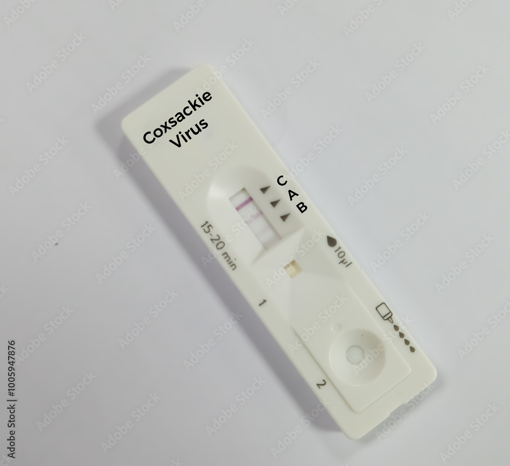 Rapid test device for Hand foot and mouth disease (HFMD) test. It is a ...