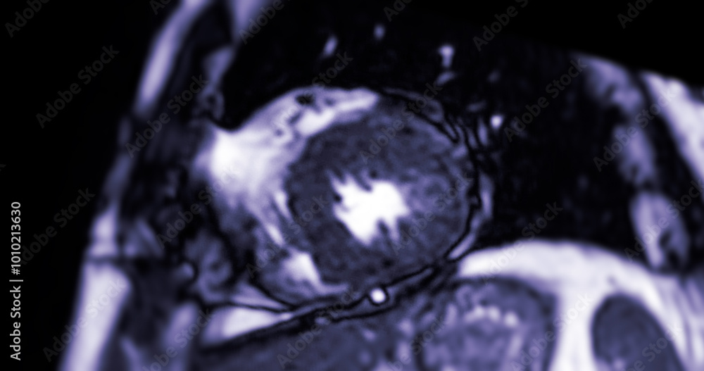 An MRI scan of the heart showing detailed cross-sectional anatomy, used ...