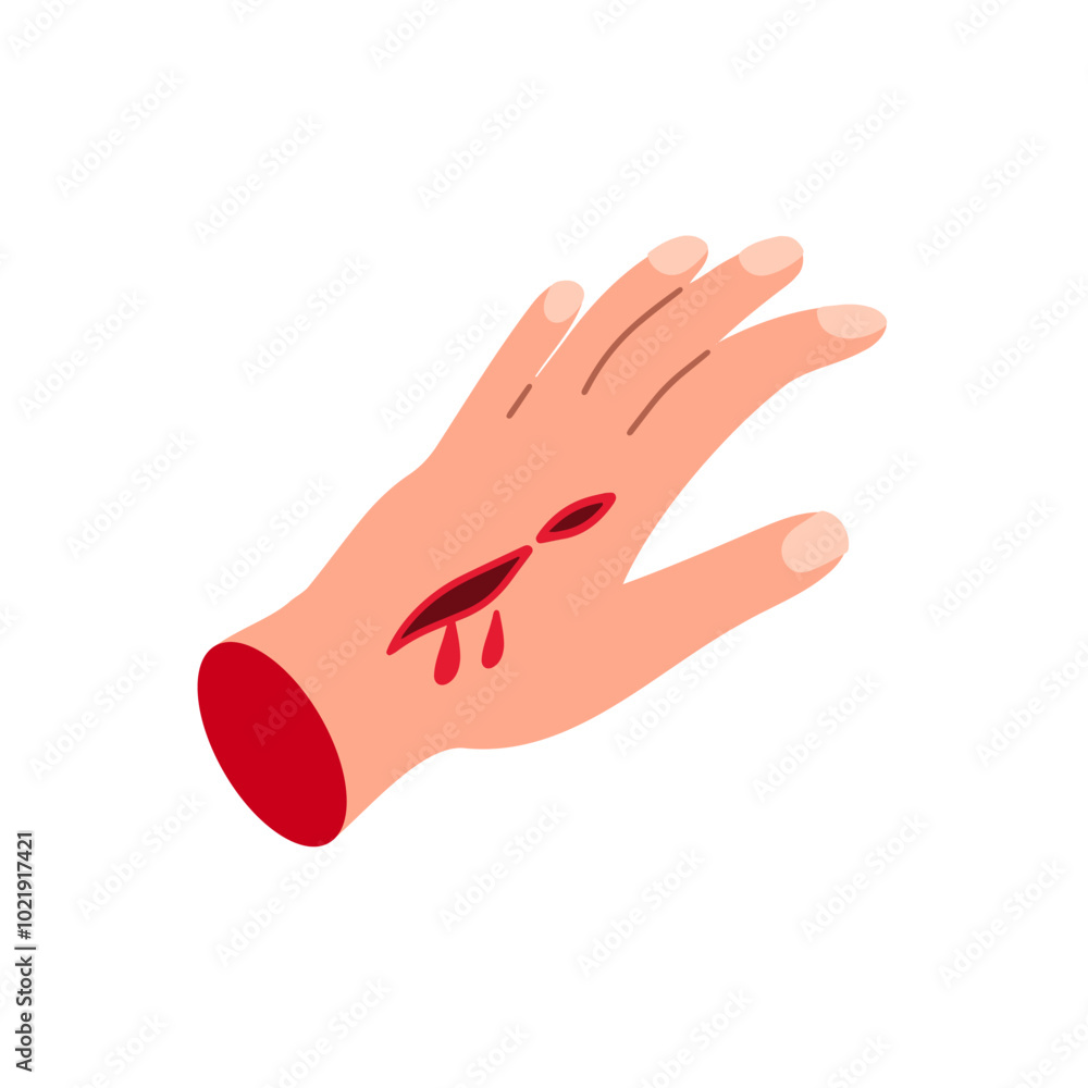 Lacerated wound on the palm. Bleeding cut, injury, accident. Vector ...