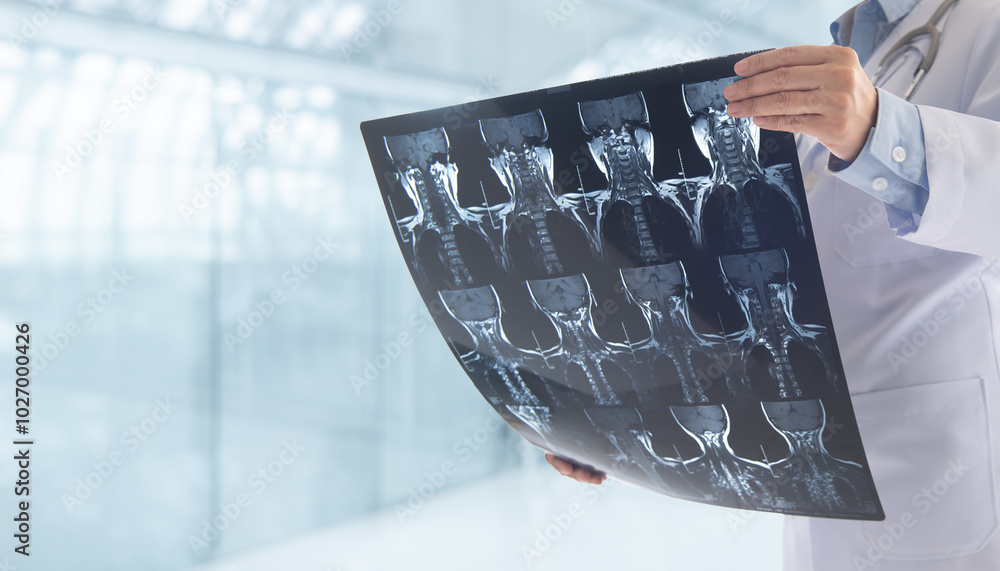 Póster Doctor radiology or surgeon check cervical spine x-ray film by ...