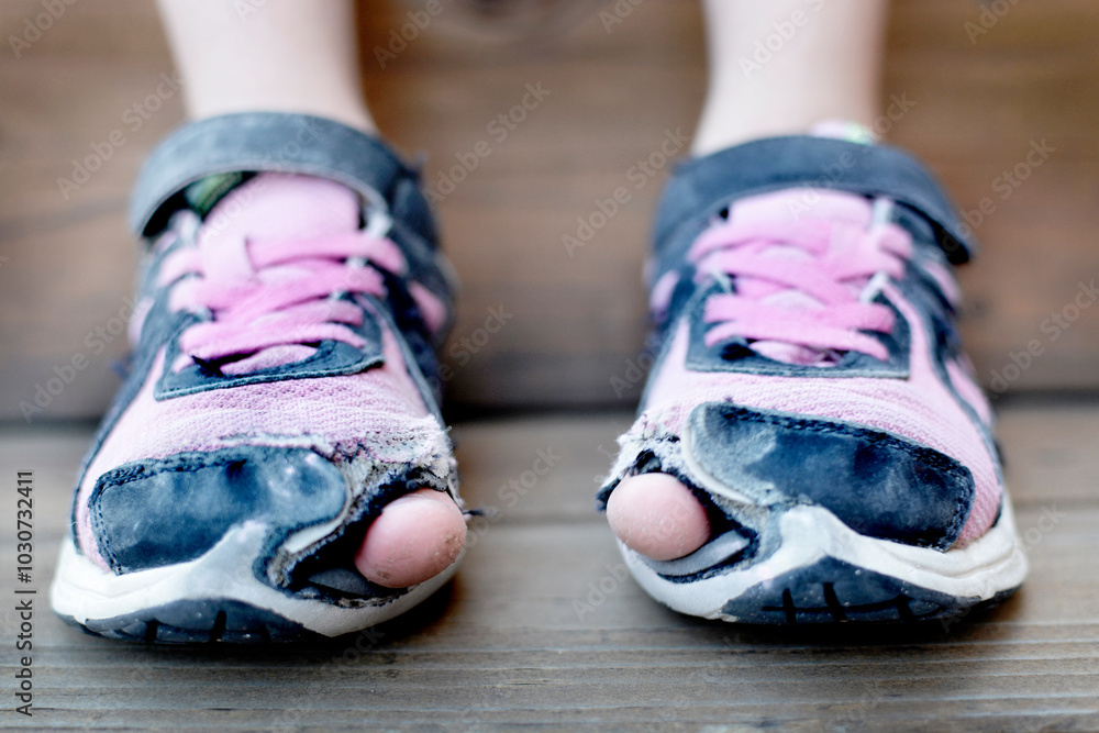 Homeless Child Wearing Old Worn Out Shoes with Holes in them Toes ...