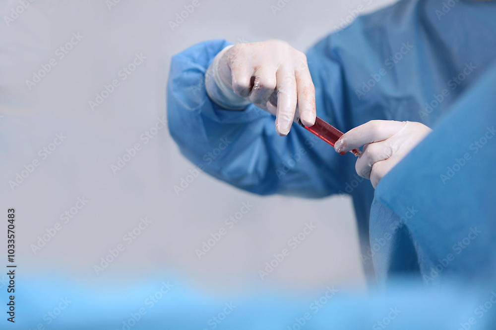 Surgery on blood vessels. Endovascular surgery. Surgical interventions ...