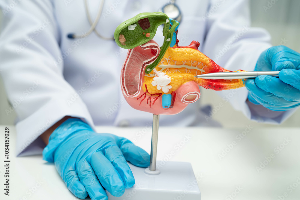 Pancreatitis, pancreatic cancer, Asian doctor with pancreas ...