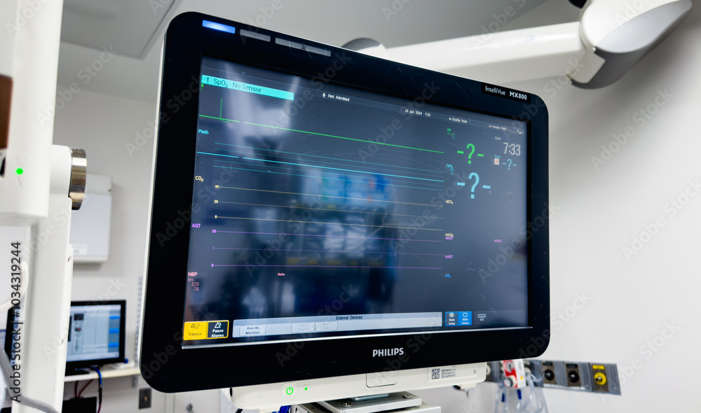 hospital monitors displaying vital signs, including heart rate, oxygen ...
