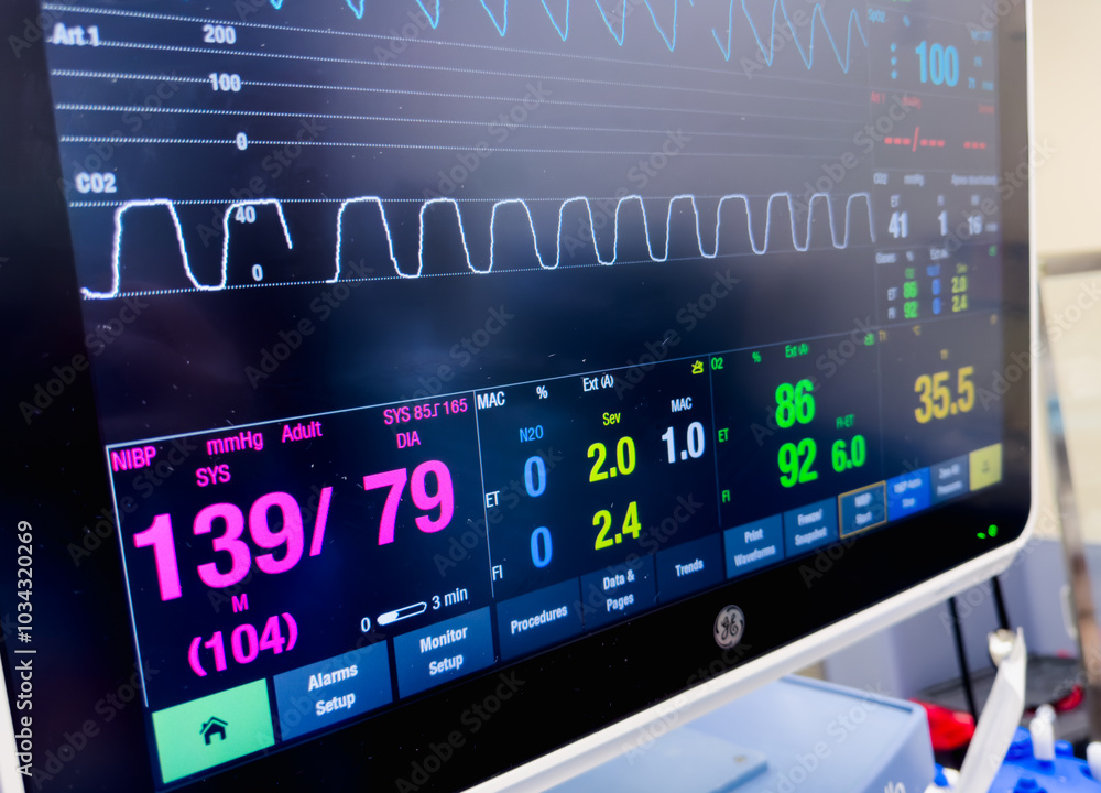 hospital monitors displaying vital signs, including heart rate, oxygen ...