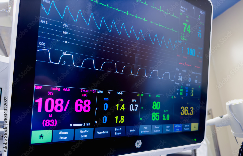hospital monitors displaying vital signs, including heart rate, oxygen ...