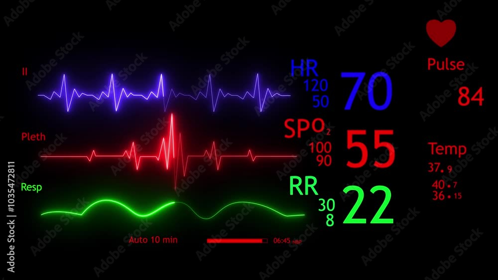 ICU medical monitor, EKG monitor in ICU unit show The waves of blood pressure, Modern equipment ...