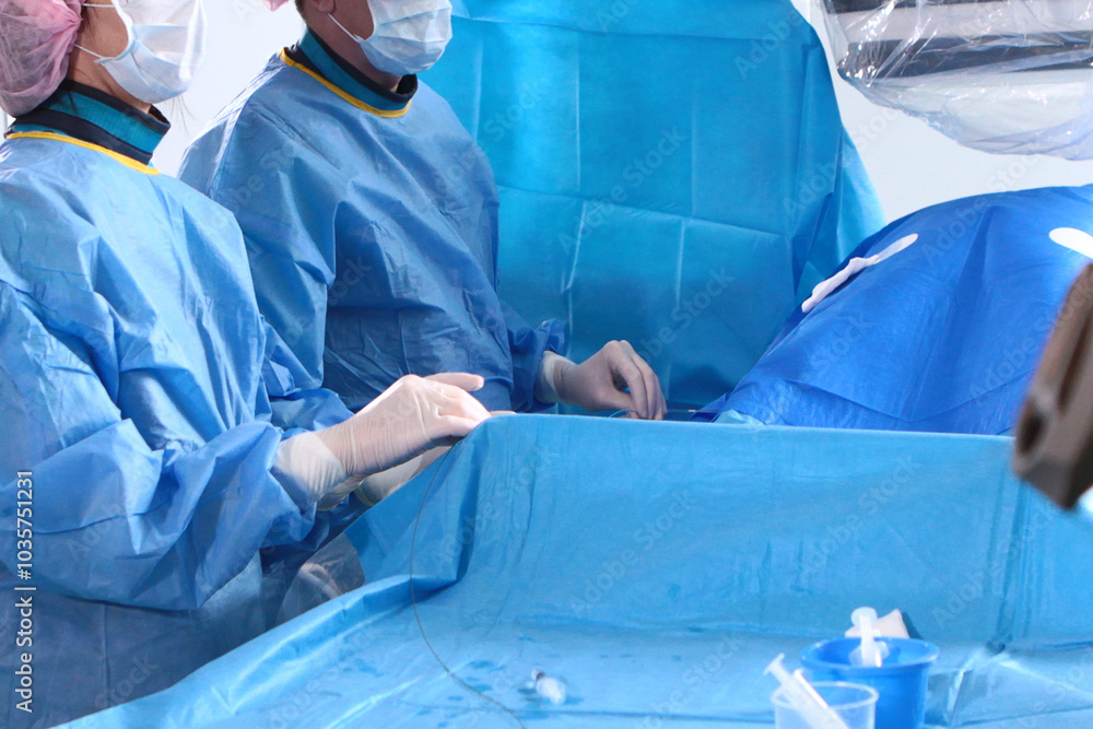 Operations on blood vessels. Endovascular surgery. Modern operating ...