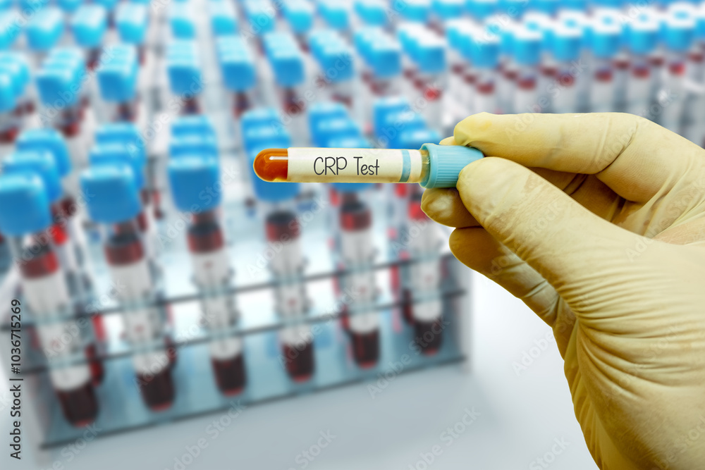 Blood Sample Collection in a Test Tube for Medical Testing and Research ...