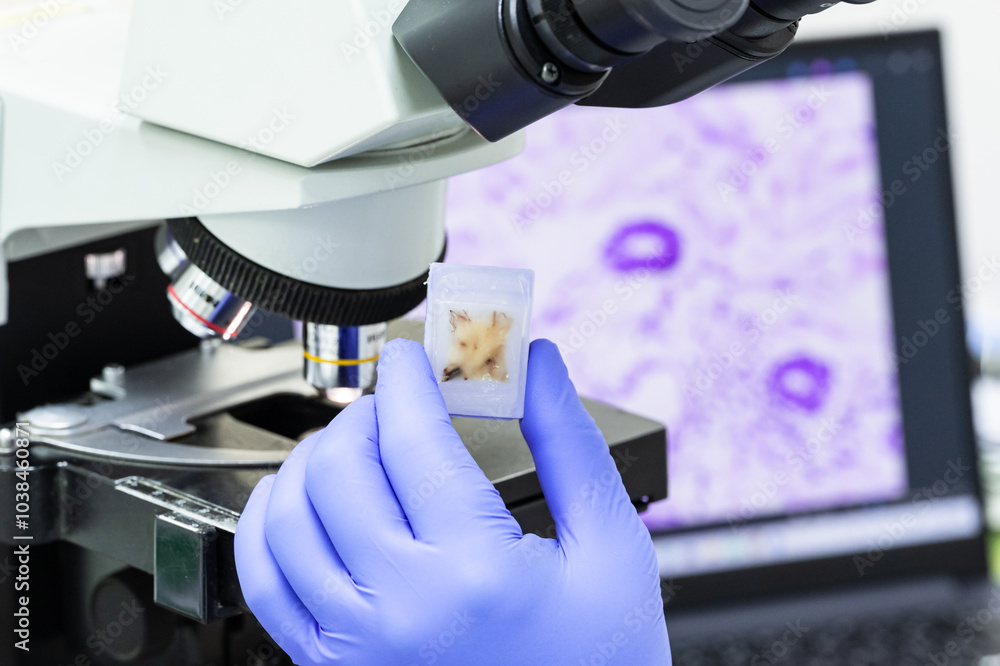Scientist wear violate glove holding parafin human tissue block and out ...