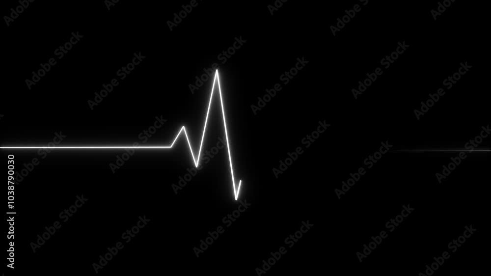 Heart rate monitor in hospital theater. Medical vital signs monitor ...