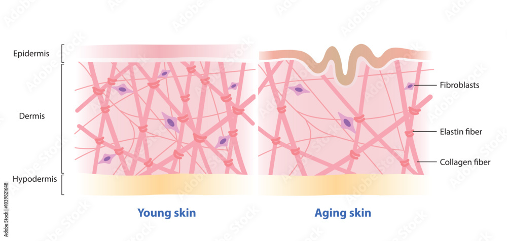Comparison of young and aging skin vector on white background. Cross ...