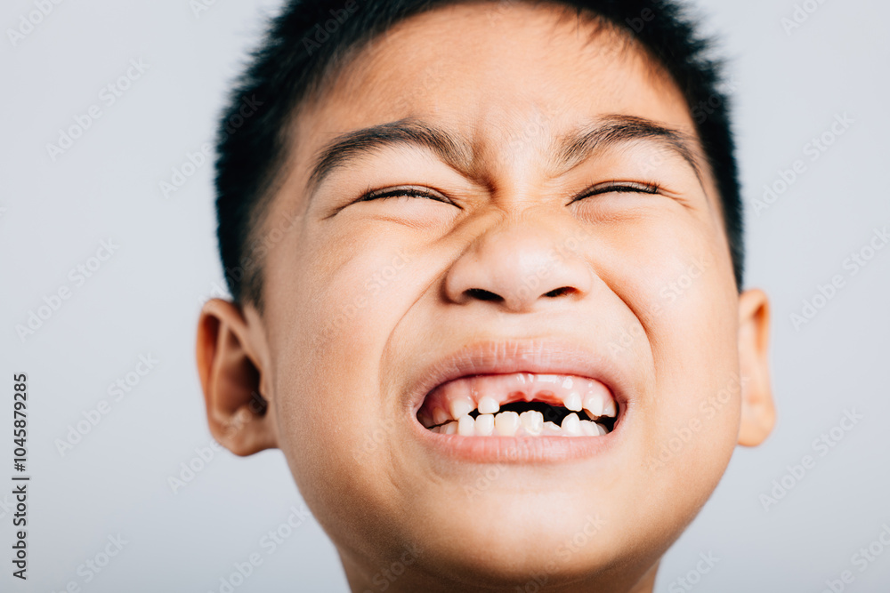 Child smile reveals lost upper tooth gap. Dental growth isolated on ...