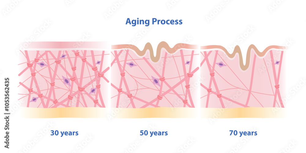Cross section of aging process skin comparison vector illustration ...