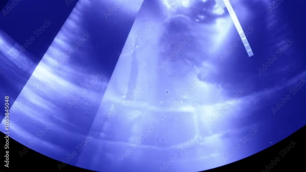 28 2D Ultrasound show Fetus important organs pregnant image weeks ...