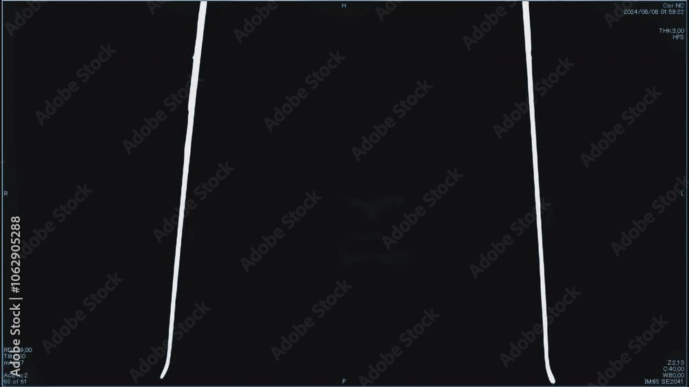 Magnetic resonance images of the brain, MRI of the brain, of a patient ...