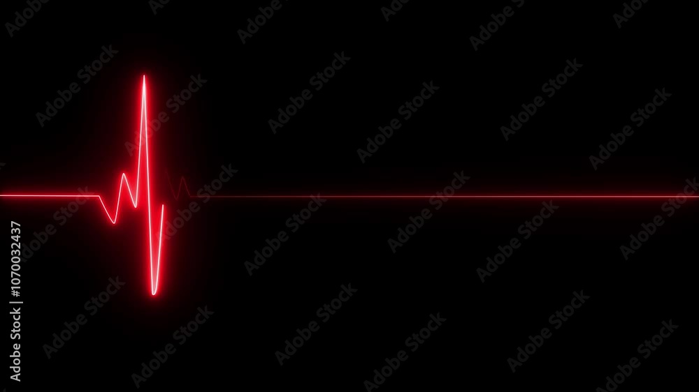 Dynamic heart rate or heart beat line. Patient monitor displays vital ...