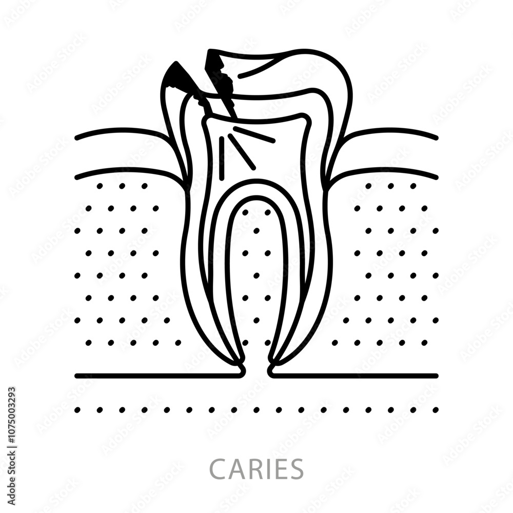 Caries, line icon. Tooth decay anatomy - enamel, pulp, bone, root canal ...